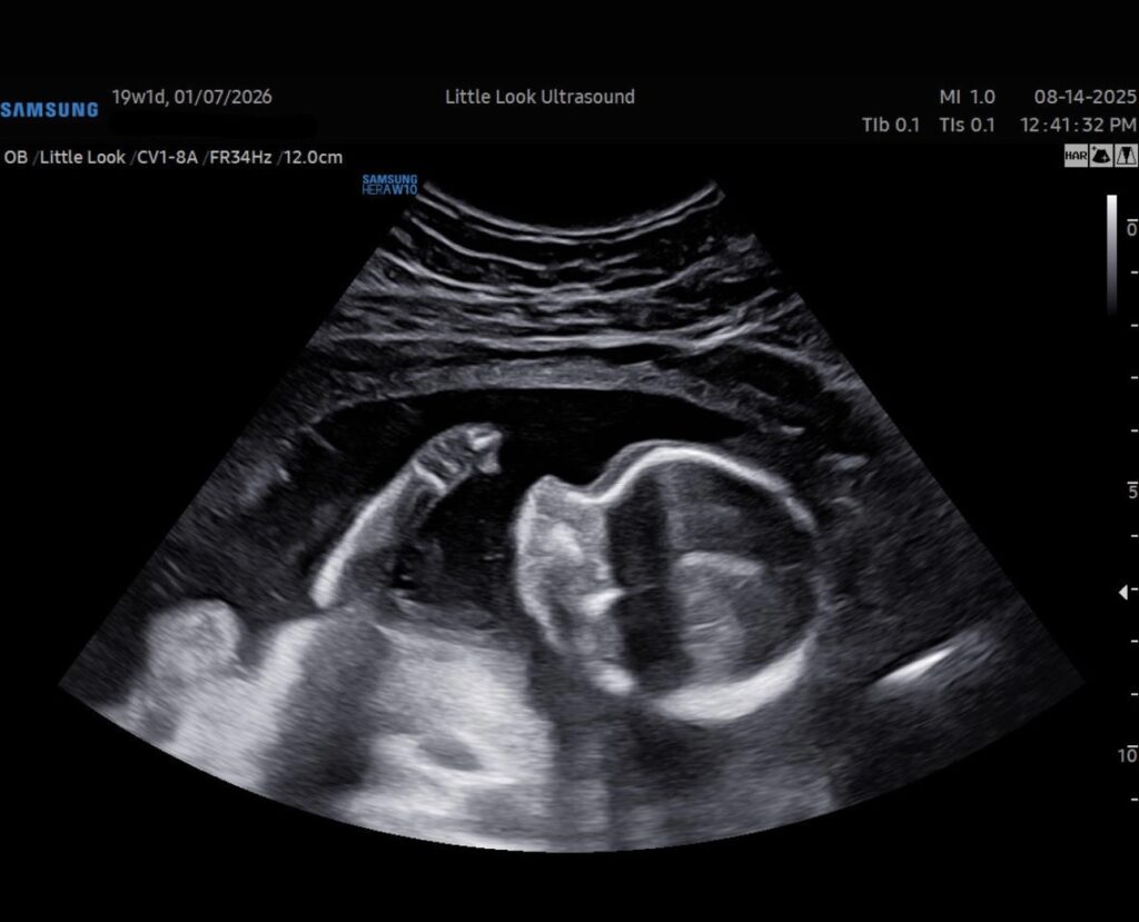 NH 3D 4D Baby Scan | Private Elective Ultrasound near MA
